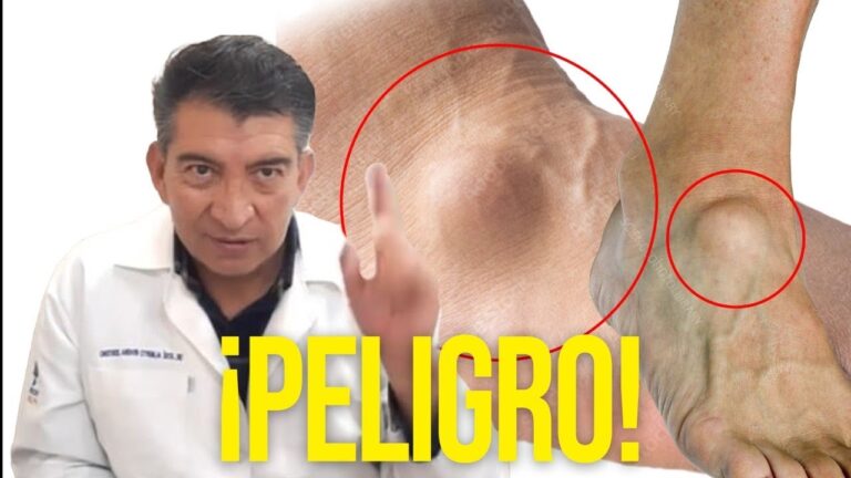 Bulto en el Empeine del Pie: Causas, Síntomas y Tratamientos Efectivos ...