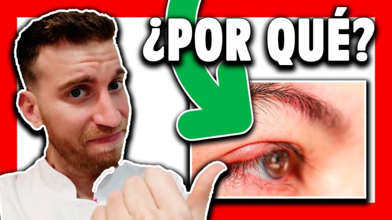 Cómo Identificar y Tratar los Bultos en el Párpado Superior del Ojo ...