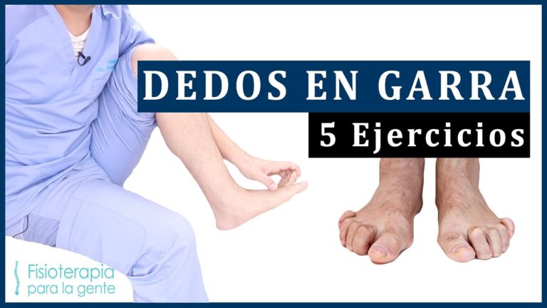 ¿Qué Son los Dedos del Pie en Forma de Garra? Causas, Síntomas y ...