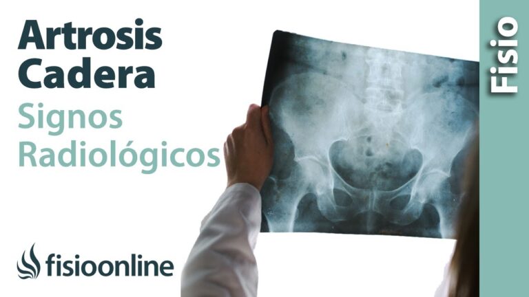 ¿Qué se Ve en una Radiografía de Cadera? Guía Completa y Explicaciones ...