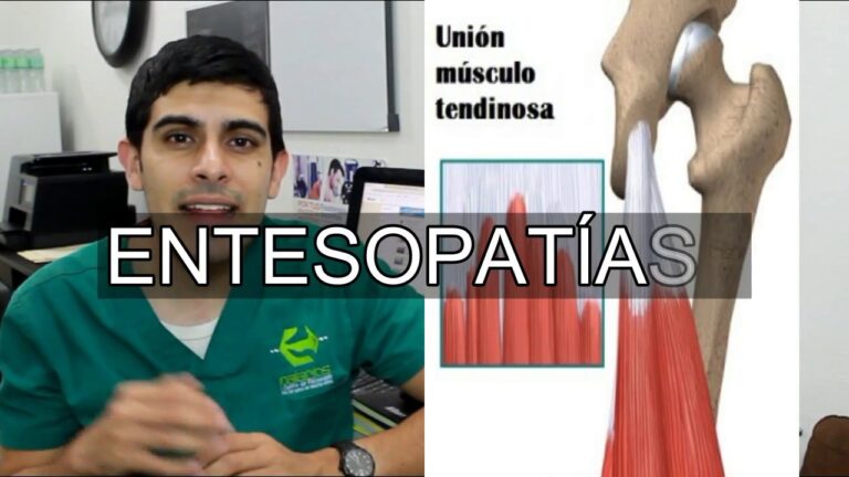Todo lo que Necesitas Saber sobre la Entesopatía Insercional del Tendón ...