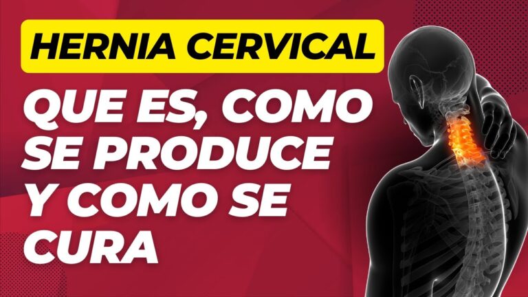 Todo sobre Hernias Cervicales C3, C4, C5 y C6: Síntomas, Tratamientos y ...